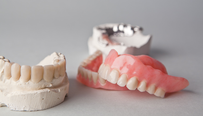 Protesi | Studio Dentistico DV DENT